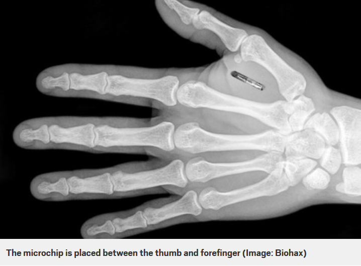 Microchips Under My Skin | Kerin & Hartley Marketing